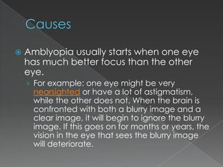 Amblyopia | PPTX | Eye and Vision Conditions | Diseases and Conditions