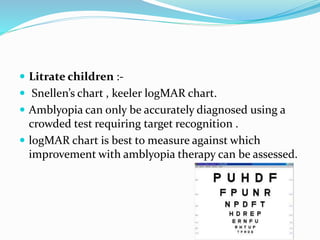 Amblyopia | PPTX