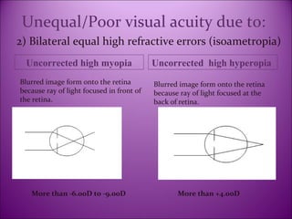 Introduction, Assessment and Management of Amblyopia | PPT