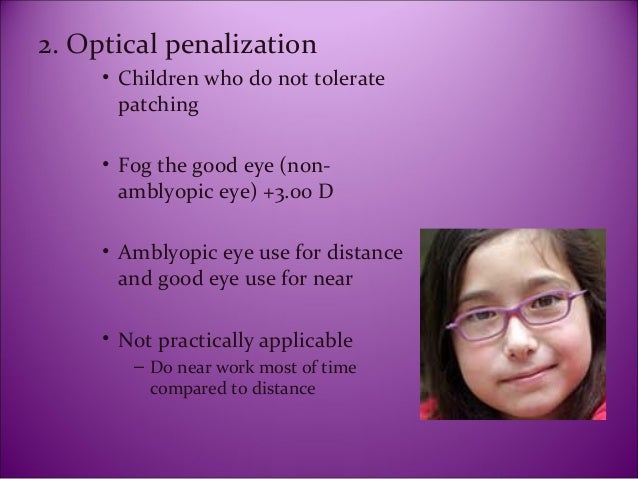 Introduction, Assessment and Management of Amblyopia