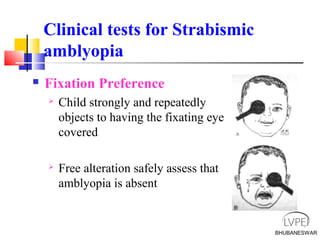 Amblyopia by surendra | PPT | Eye and Vision Conditions | Diseases and Conditions