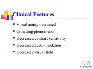 Amblyopia by surendra | PPT | Eye and Vision Conditions | Diseases and ...