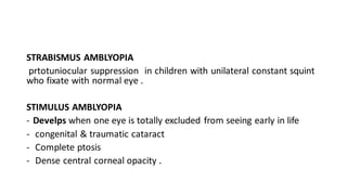 Amblyopia | PPT
