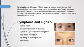 Amblyopia.pptx