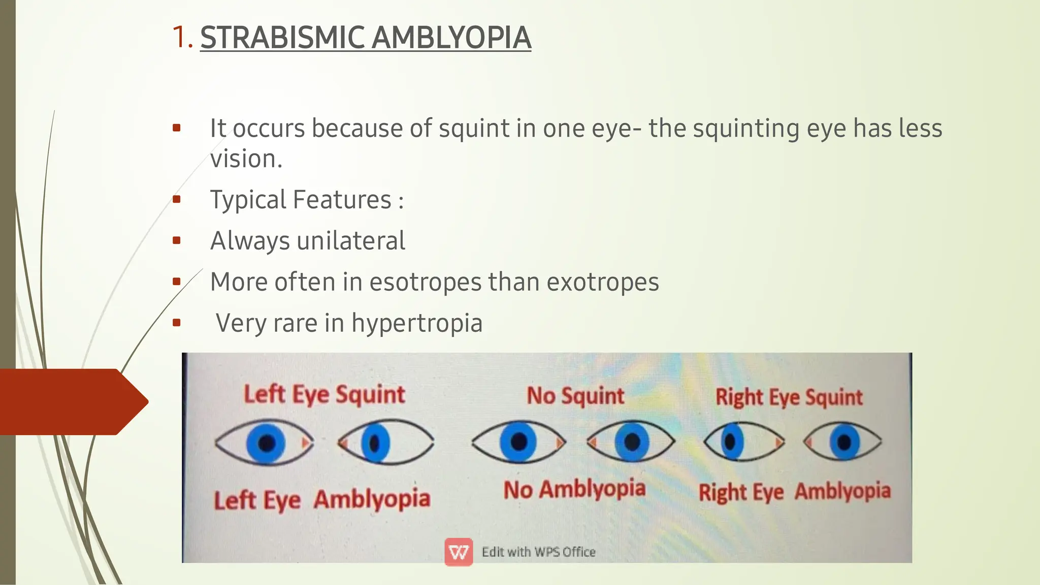 Excercise and Treatment AMBLYOPIA.pdf