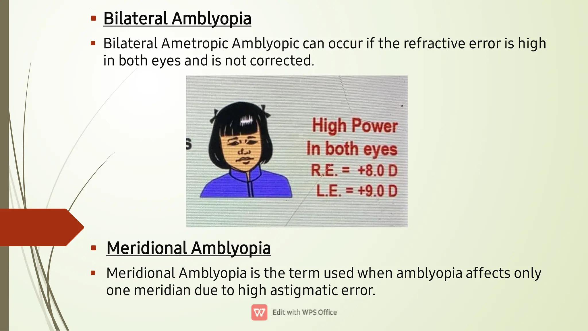 Excercise and Treatment AMBLYOPIA.pdf