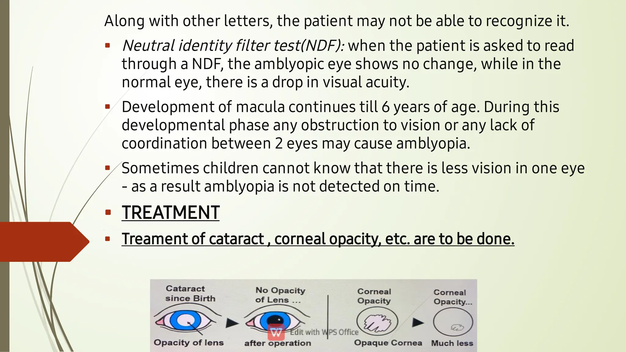 Excercise and Treatment AMBLYOPIA.pdf