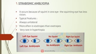 Excercise and Treatment AMBLYOPIA.pdf