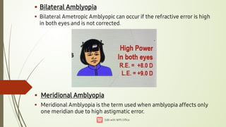 Excercise and Treatment AMBLYOPIA.pdf