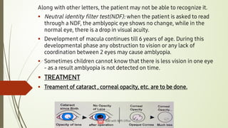 Excercise and Treatment AMBLYOPIA.pdf