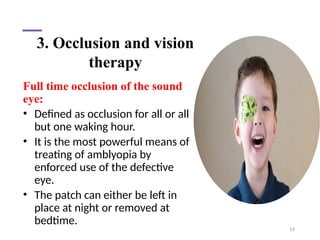 Amblyopia vision therapy for optometry students | PPT