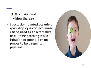 Amblyopia vision therapy for optometry students | PPTX