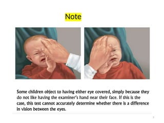 Amblyopia vision therapy for optometry students | PPTX