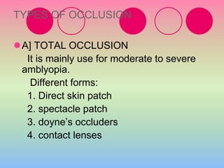 Amblyopia 3 rd year arya | PPT