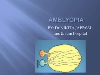 Amblyopia | PPTX