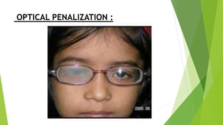 Amblyopia | PPTX | Eye and Vision Conditions | Diseases and Conditions
