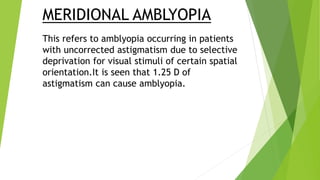 Amblyopia | PPTX | Eye and Vision Conditions | Diseases and Conditions