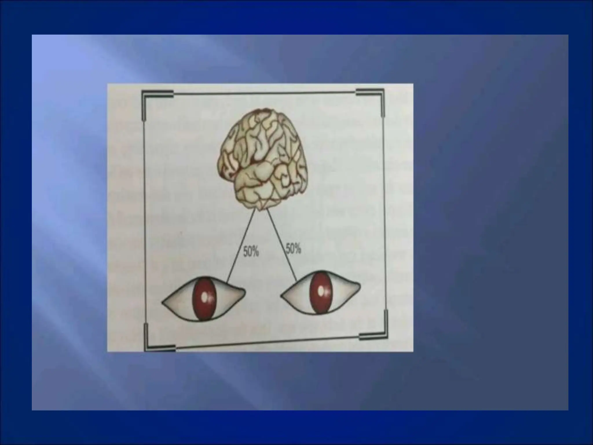 AMBLYOPIA CLASSIFICATION-SQUINT.ppt classification of ambylopia ppt | PPT