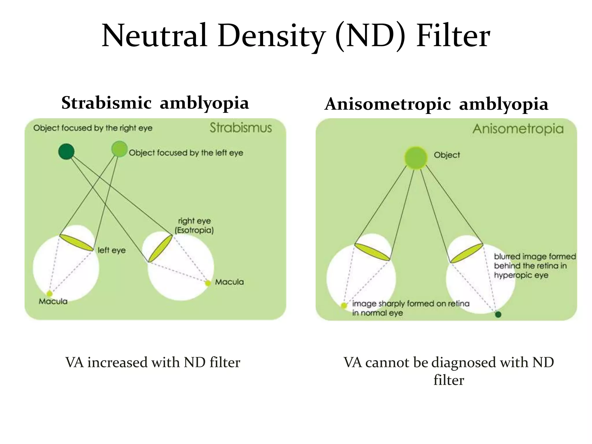 AMBLYOPIA, CLASSIFICATION & MANAGEMENT - Modified.pptx