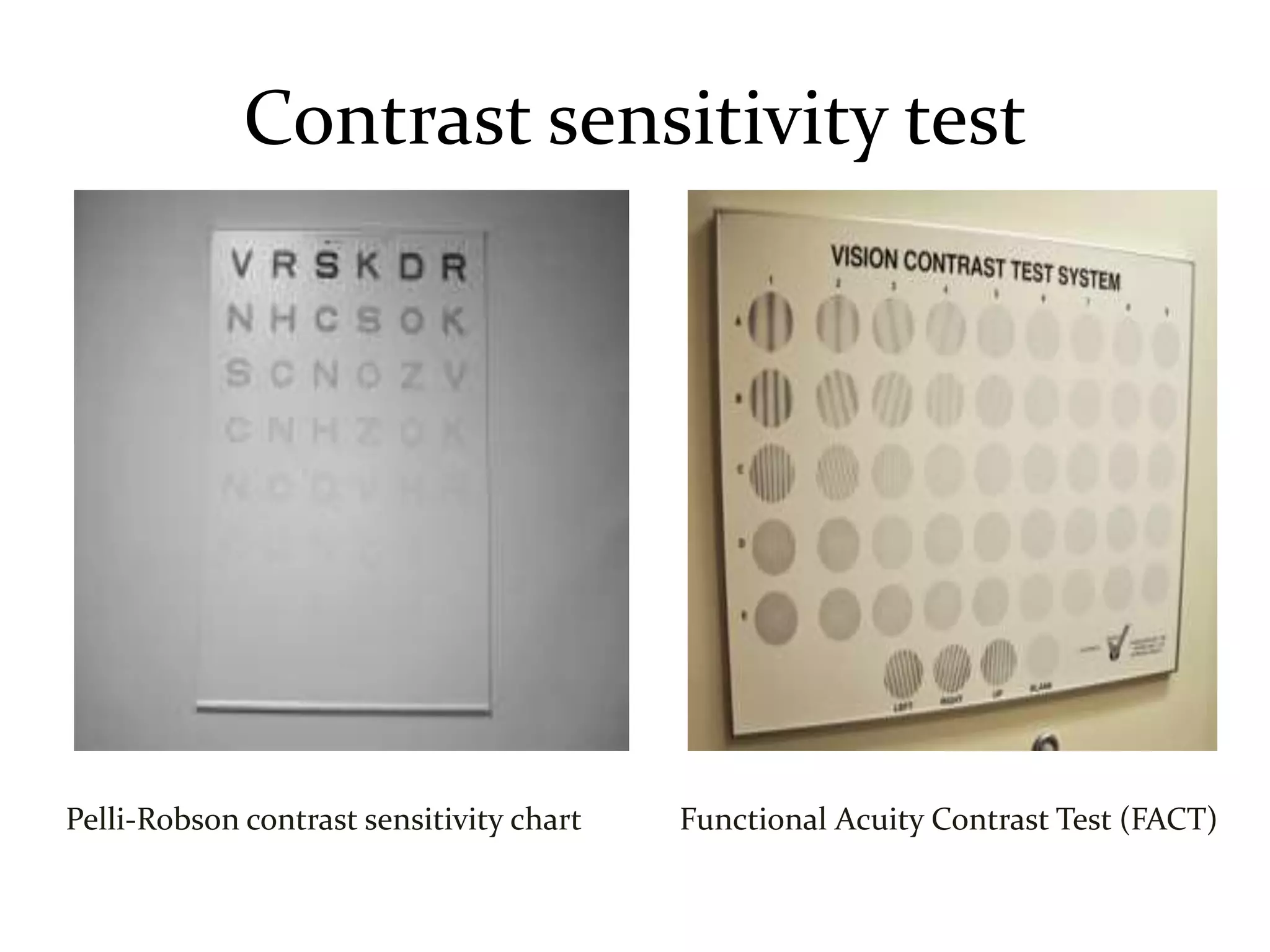 AMBLYOPIA, CLASSIFICATION & MANAGEMENT - Modified.pptx