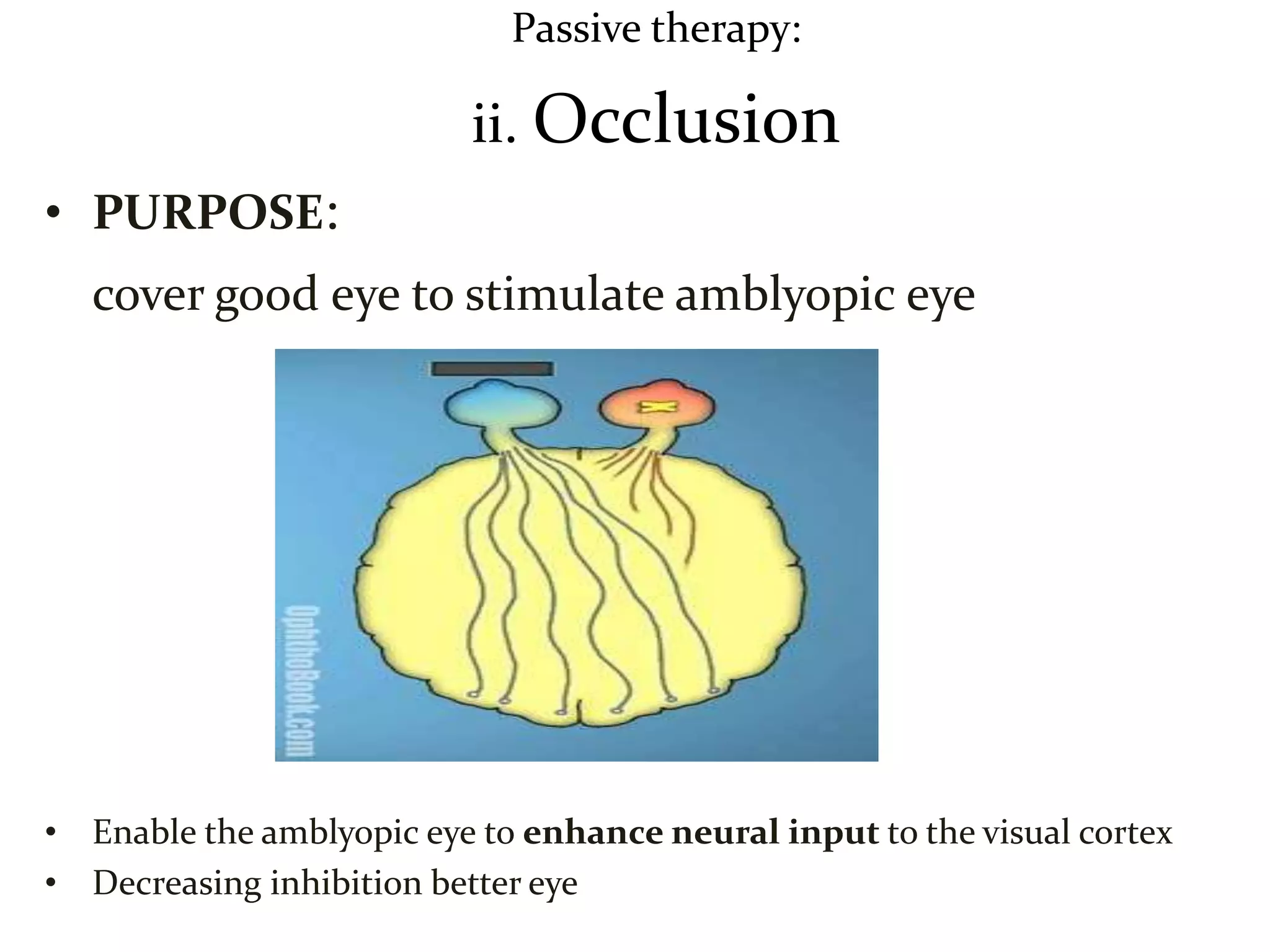 AMBLYOPIA, CLASSIFICATION & MANAGEMENT - Modified.pptx