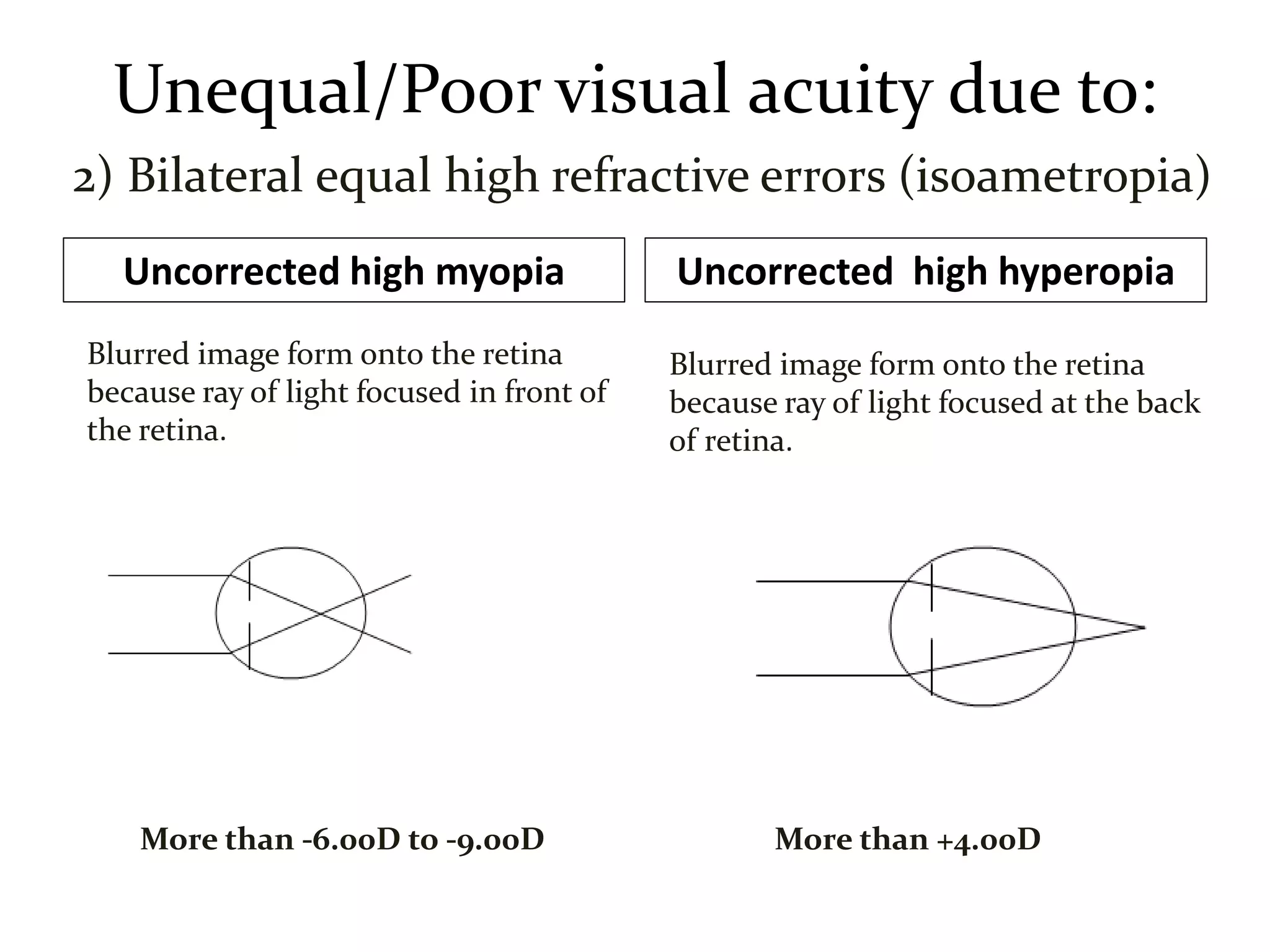 AMBLYOPIA, CLASSIFICATION & MANAGEMENT - Modified.pptx