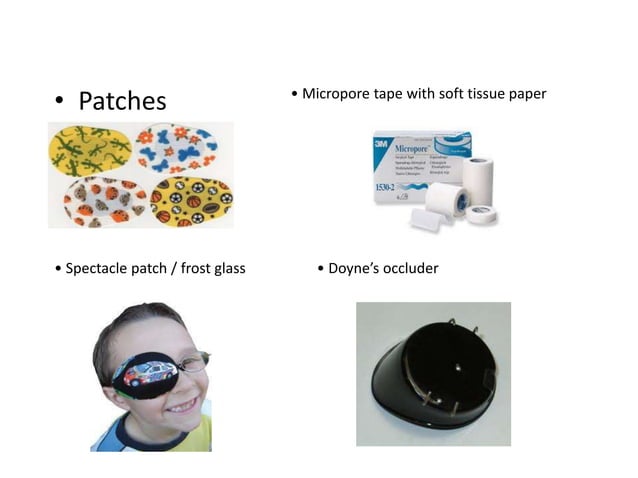 AMBLYOPIA, CLASSIFICATION & MANAGEMENT - Modified.pptx