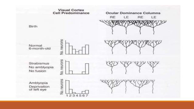 Amblyopia : classification & Occlusion therapy | PPTX | Eye and Vision ...