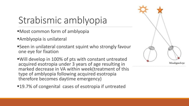 Amblyopia : classification & Occlusion therapy | PPTX | Eye and Vision ...