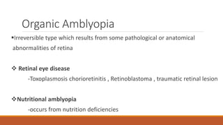 Amblyopia : classification & Occlusion therapy | PPTX