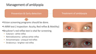 Amblyopia : classification & Occlusion therapy | PPTX