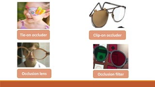 Amblyopia : classification & Occlusion therapy | PPTX