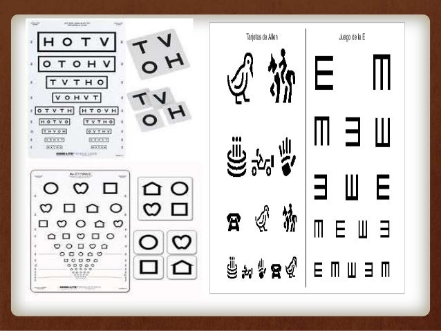 AMBLYOPIA AND ITS MANAGEMENT
