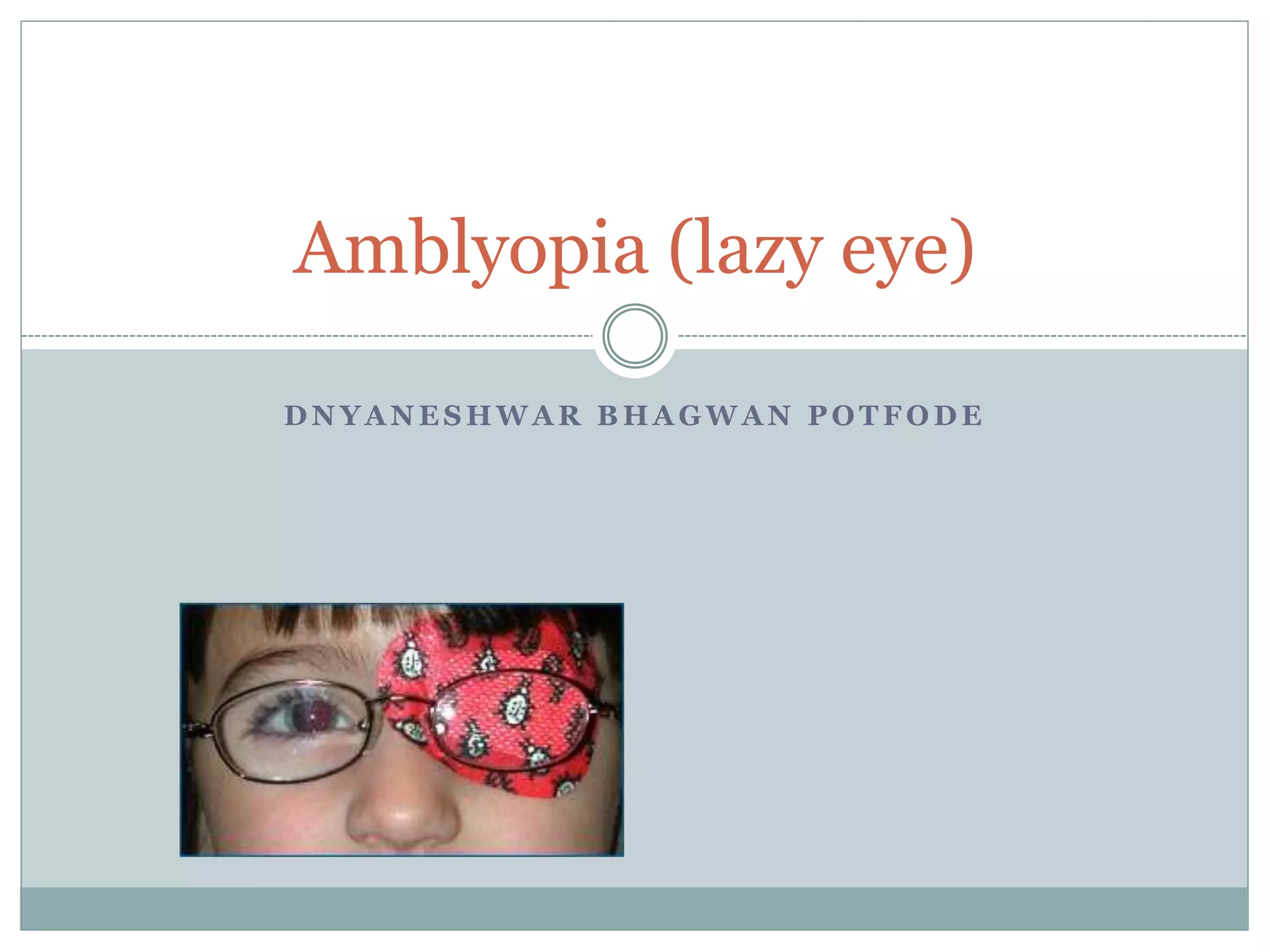 Amblyopia (lazy eye) | PPTX