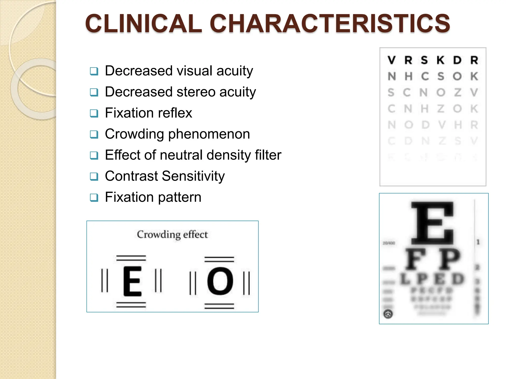 AMBLYOPIA (LAZY EYE).pptx lasy eye human disorder | PPTX