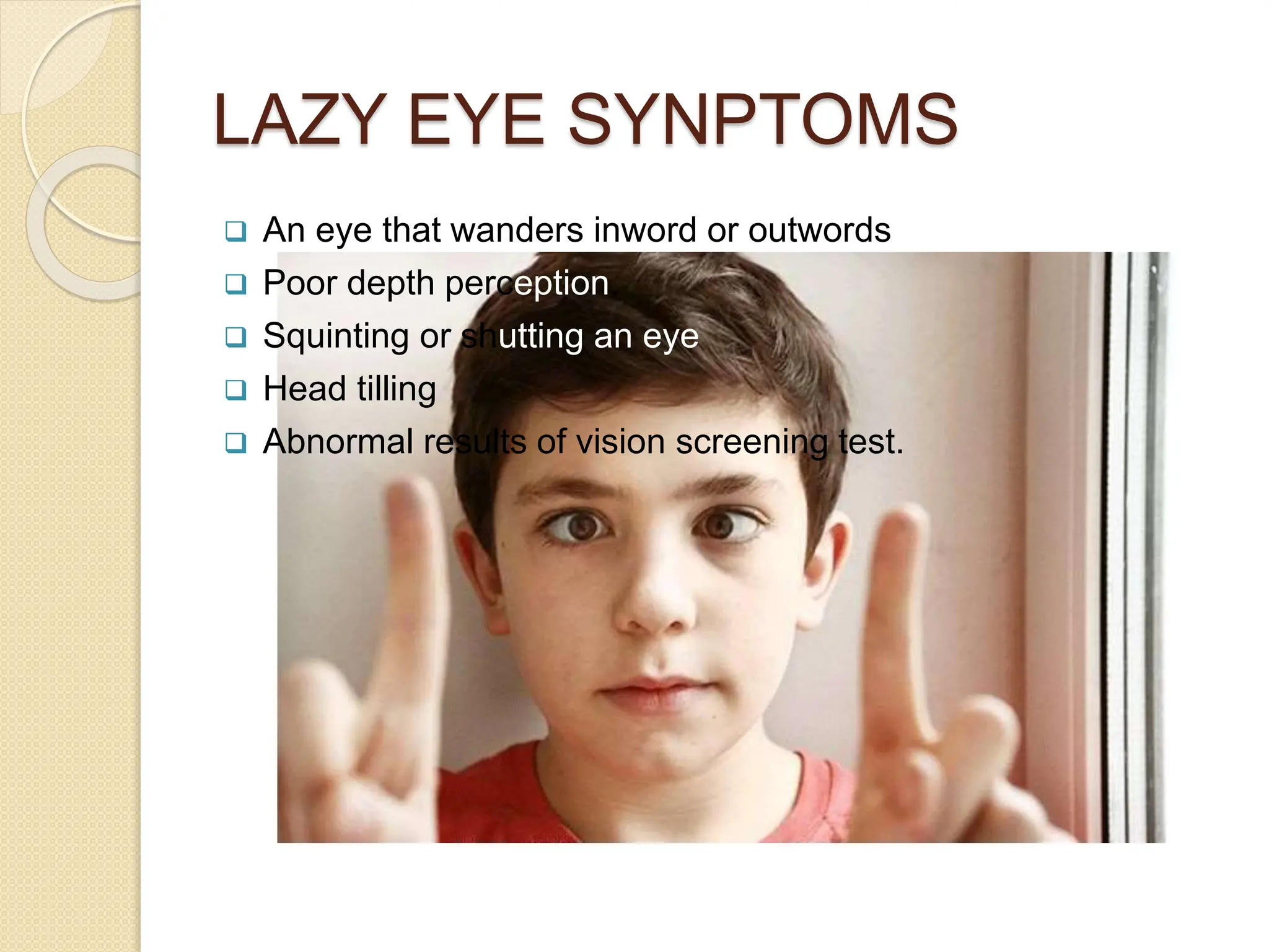 AMBLYOPIA (LAZY EYE).pptx lasy eye human disorder | PPTX
