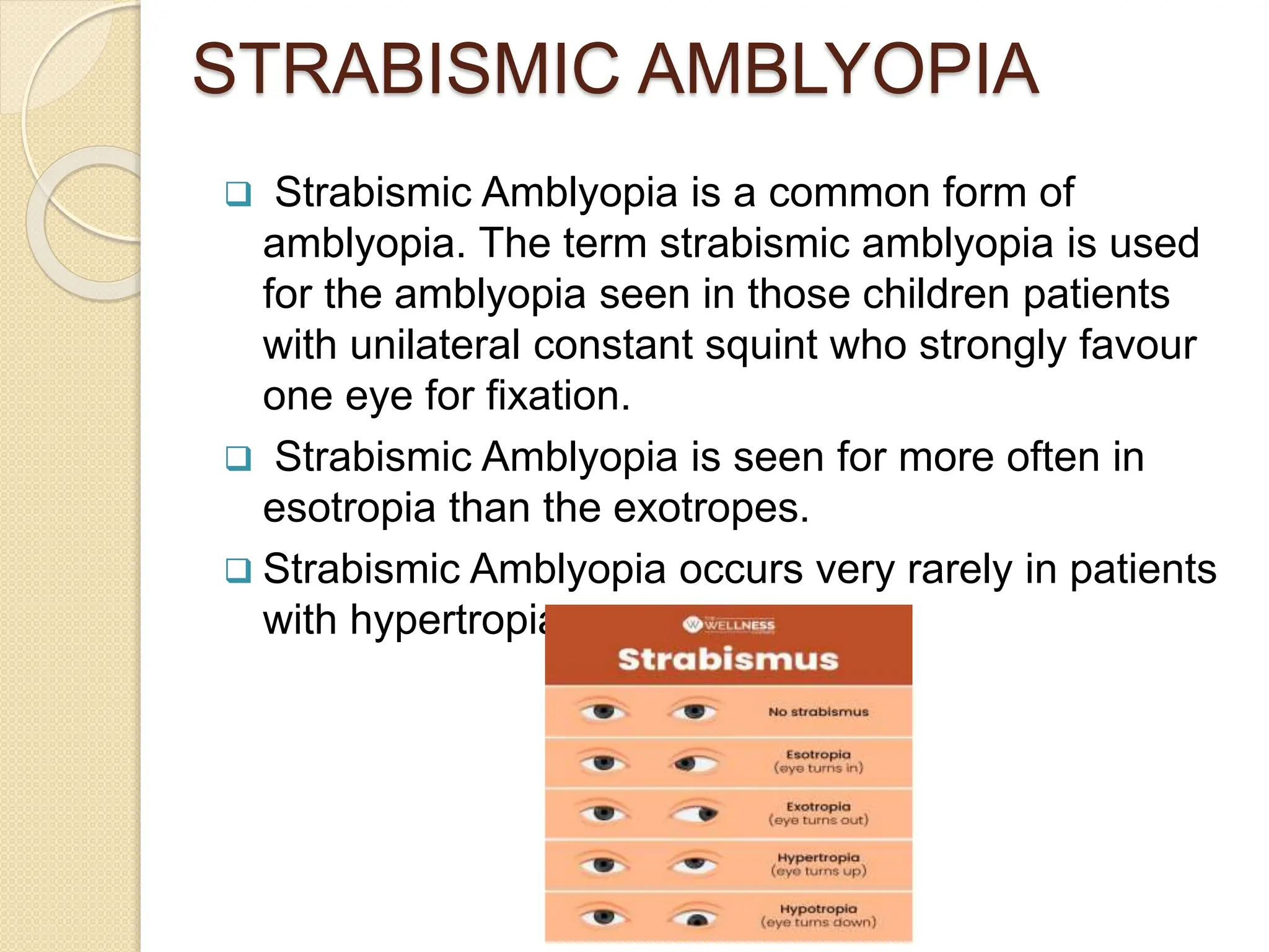 AMBLYOPIA (LAZY EYE).pptx lasy eye human disorder | PPTX