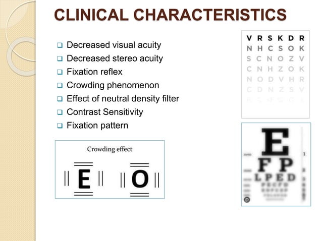 Amblyopia Lazy Eye Pptx Lasy Eye Human Disorder Pptx