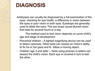 AMBLYOPIA (LAZY EYE).pptx lasy eye human disorder | PPTX