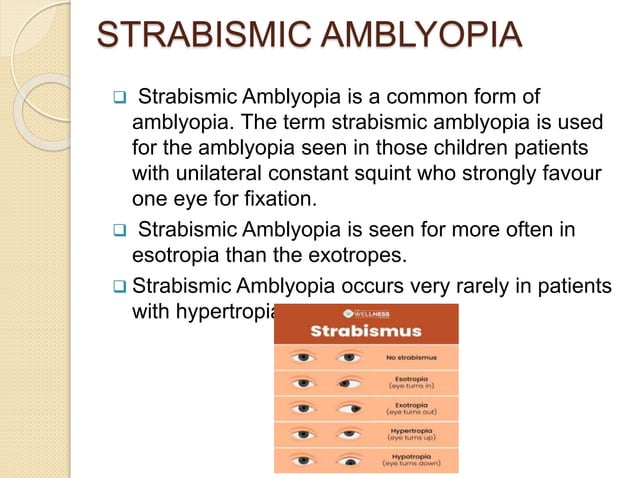 AMBLYOPIA (LAZY EYE).pptx lasy eye human disorder | PPTX