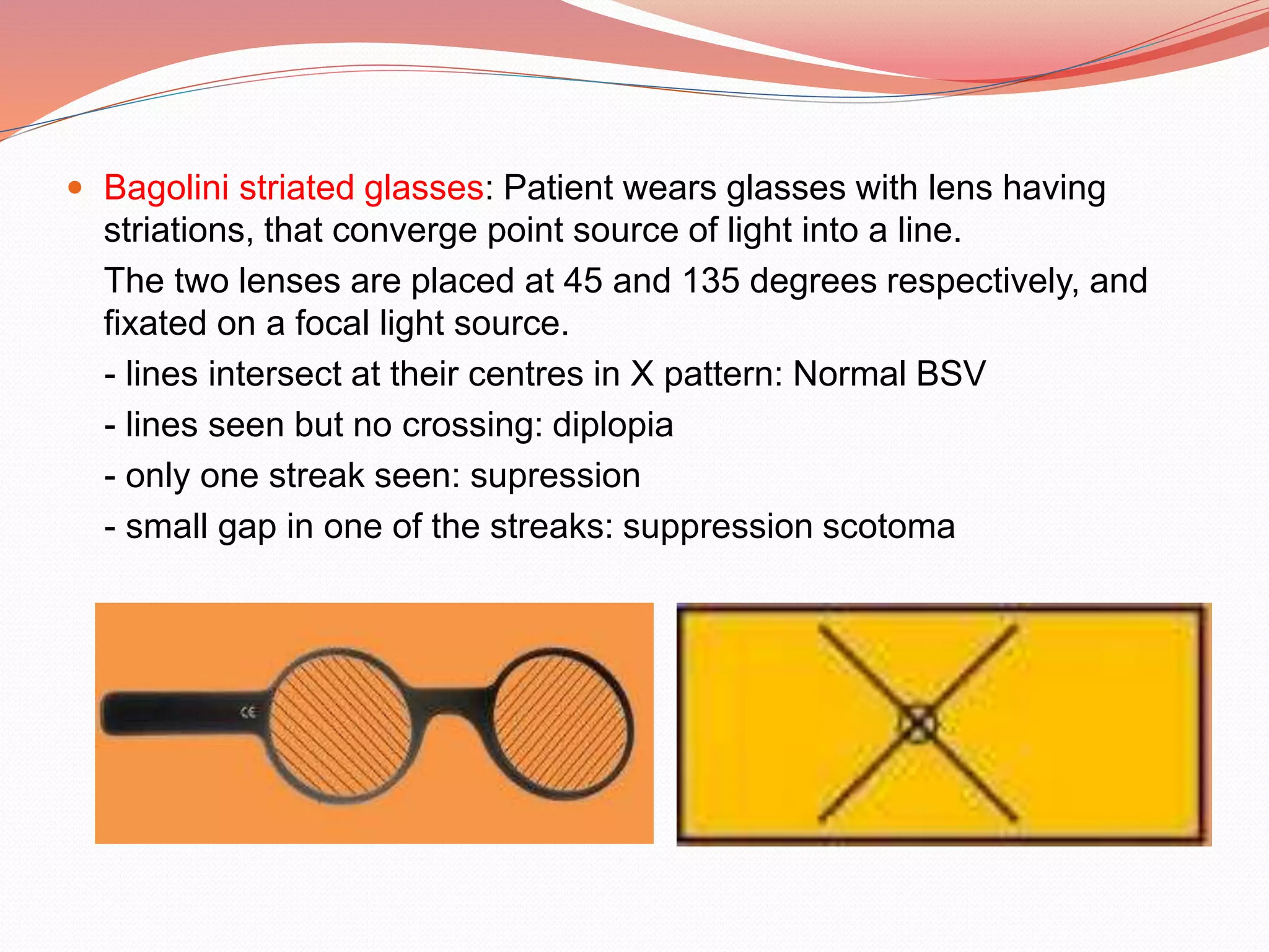 Amblyopia: Screening and Management | PPTX