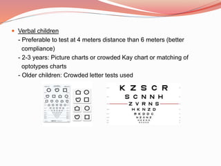 Amblyopia: Screening and Management | PPTX