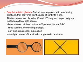 Amblyopia: Screening and Management | PPTX