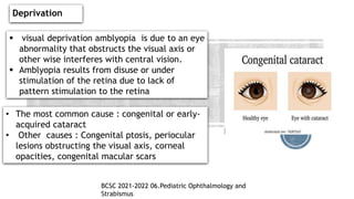 amblyopia ppt.edit.pptx