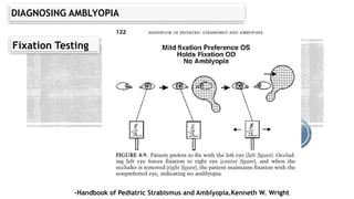 amblyopia ppt.edit.pptx