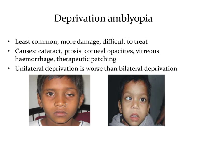 Amblyopia | PPTX | Eye and Vision Conditions | Diseases and Conditions