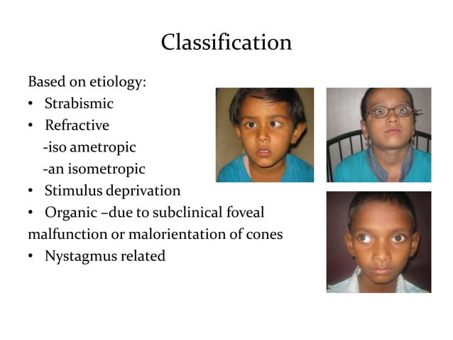 Amblyopia | PPTX | Eye and Vision Conditions | Diseases and Conditions