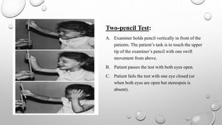 Amblyopia and it's Management | PPTX