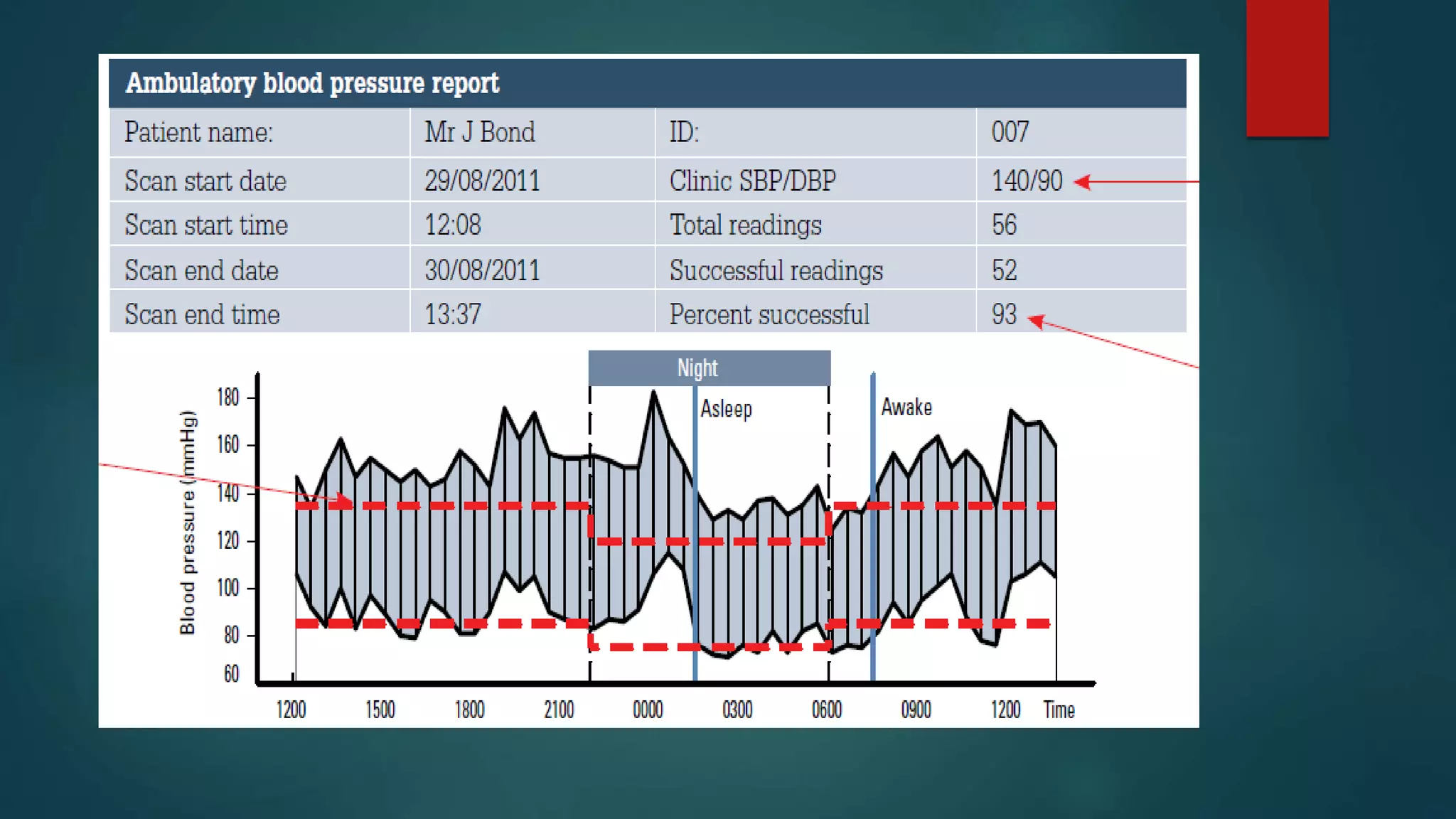 Ambulatory blood pressure monitoring [abpm] | PPTX | Heart and ...