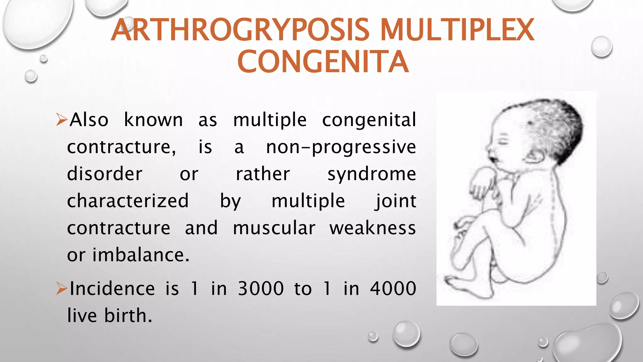 Arthrogryposis Multiplex Congenita | PPTX